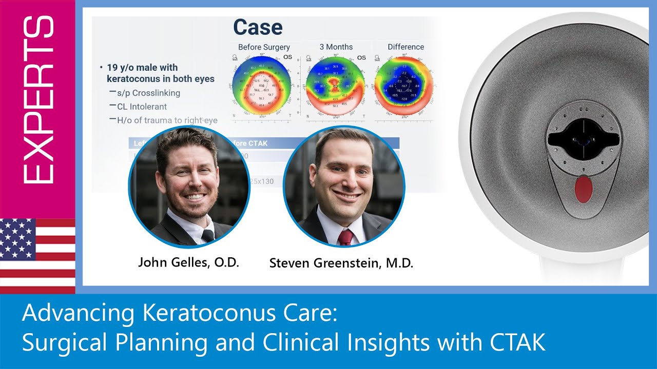 Advancing Keratoconus Care: Surgical Planning and Clinical Insights ...
