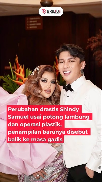 Perubahan drastis Shindy Samuel usai potong lambung dan oplas, penampilannya dipuji bak masih ...