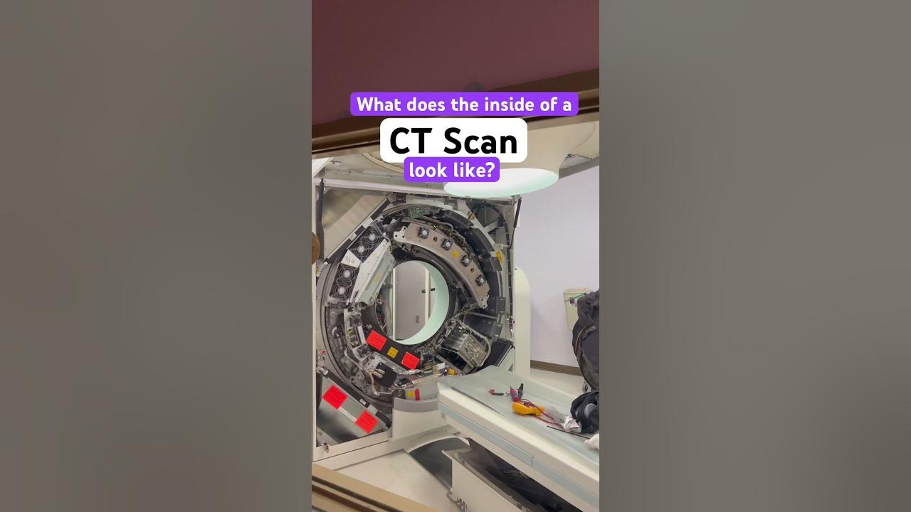 Shocking Look Inside CT Scan Equipment 😱 - YouTube