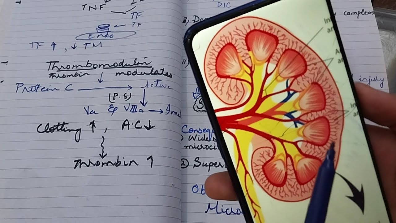 DIC | Disseminated intravascular coagulation (part 2). easy explanation ...