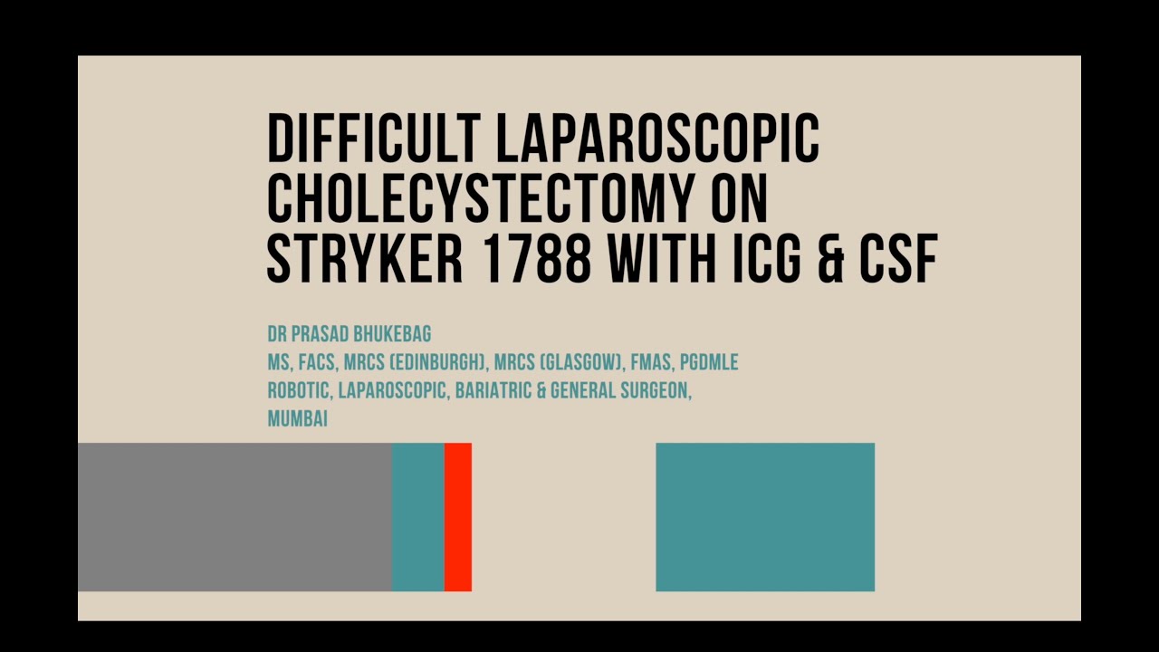 Difficult Laparoscopic Cholecystectomy on Stryker 1788 (ICG and Colour ...