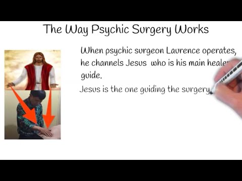 How psychic Surgery Works - YouTube