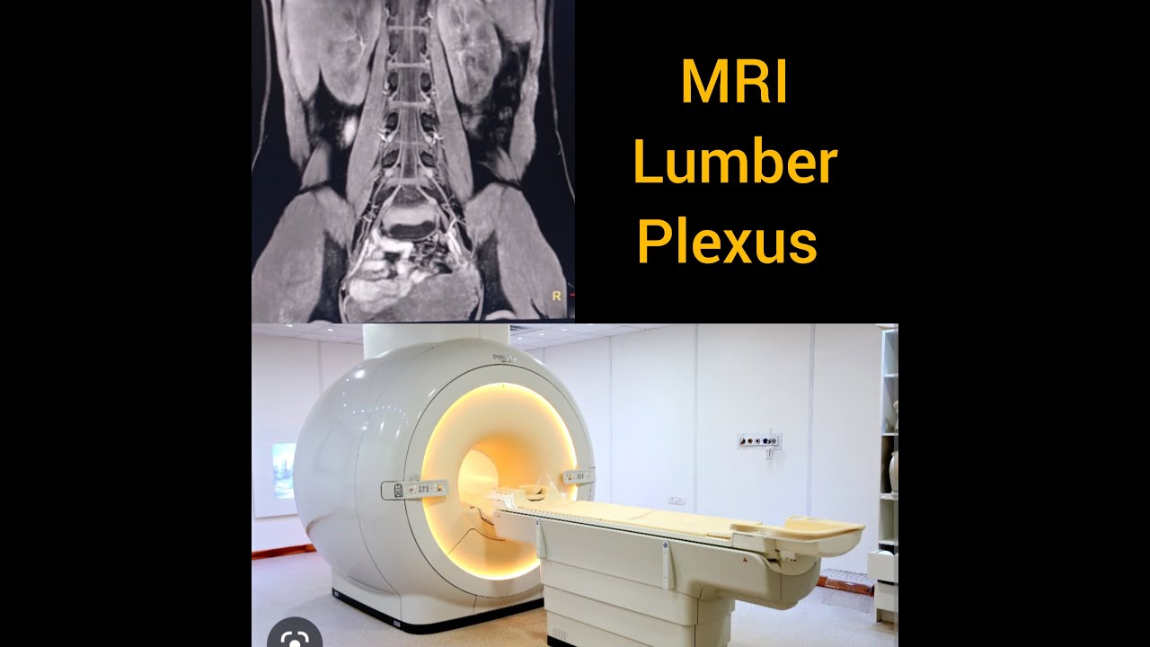 MRI Lumbar plexus and processing on Philips read description - YouTube