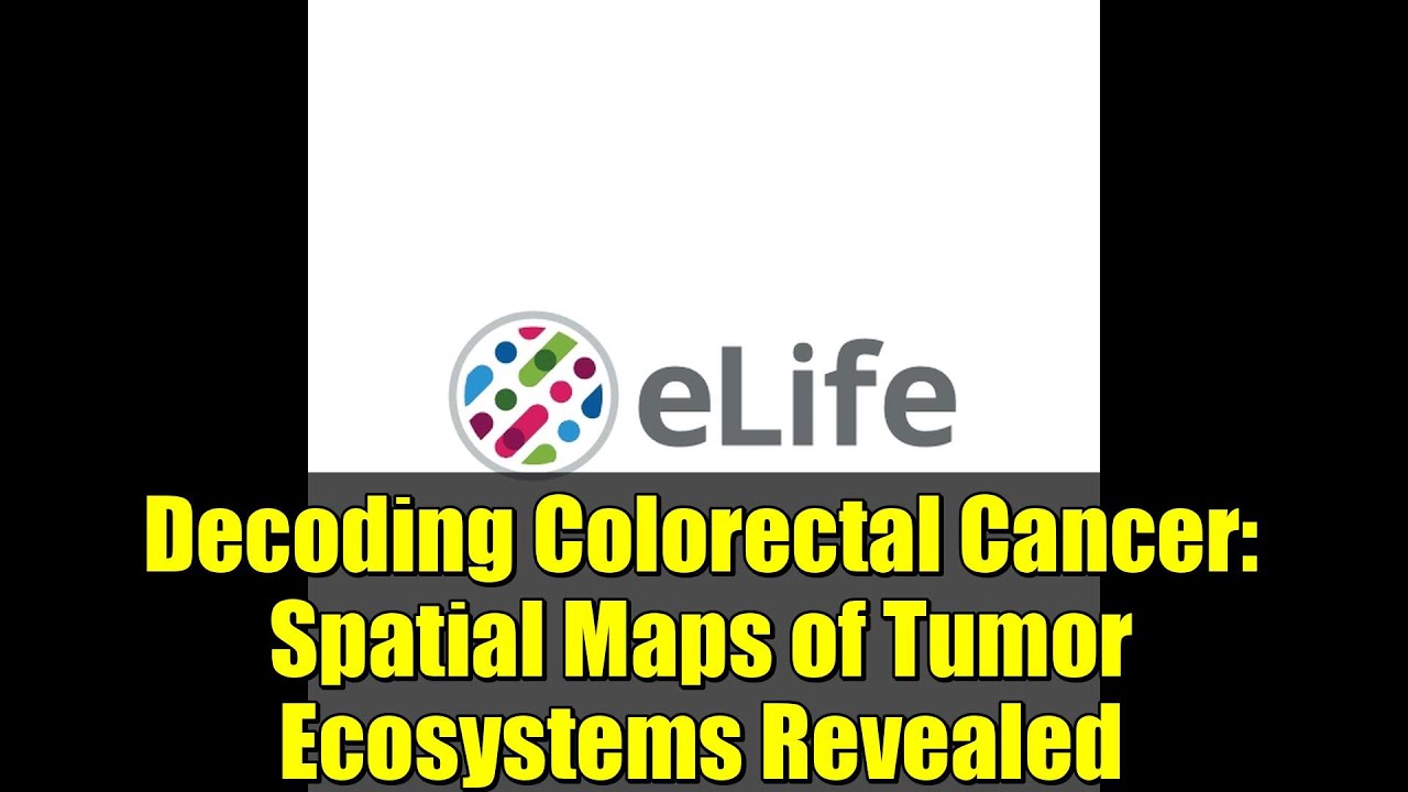 Decoding Colorectal Cancer: Spatial Maps of Tumor Ecosystems Revealed ...