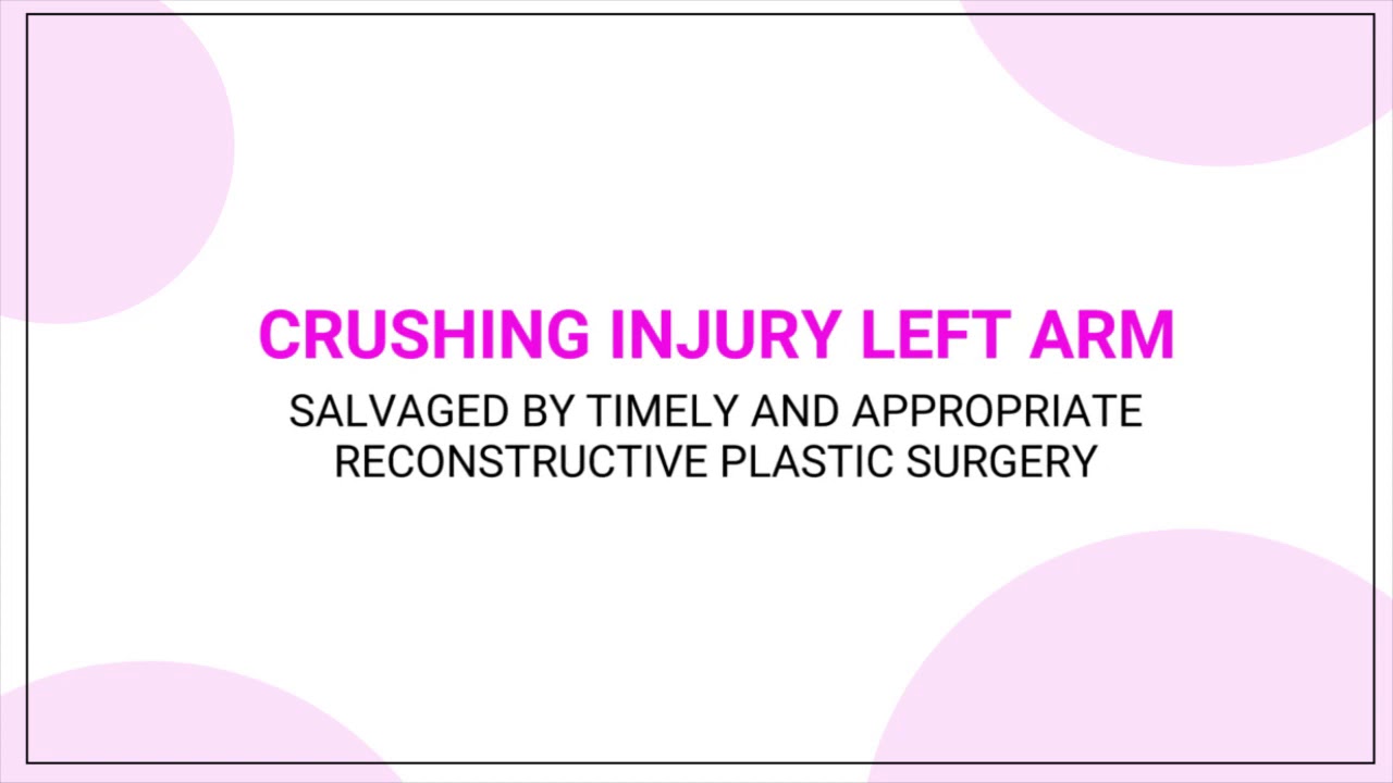 Crushed left arm saved by Reconstructive Plastic Surgery - YouTube