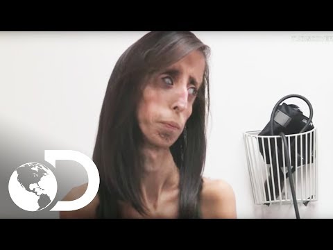 La mujer sin grasa corporal | Mi Cuerpo, Mi Desafío l Discovery Latinoamérica