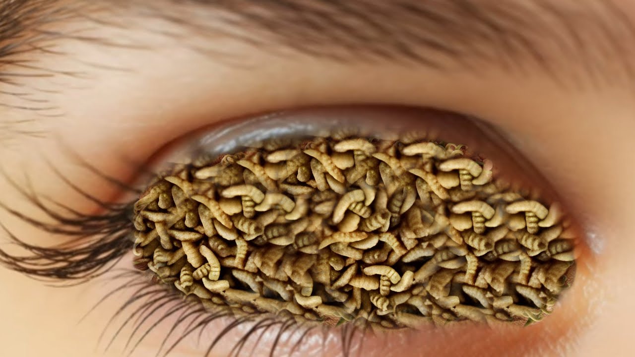 ASMR Treatment of infection form girl eyes| 2d asmr animation video ...