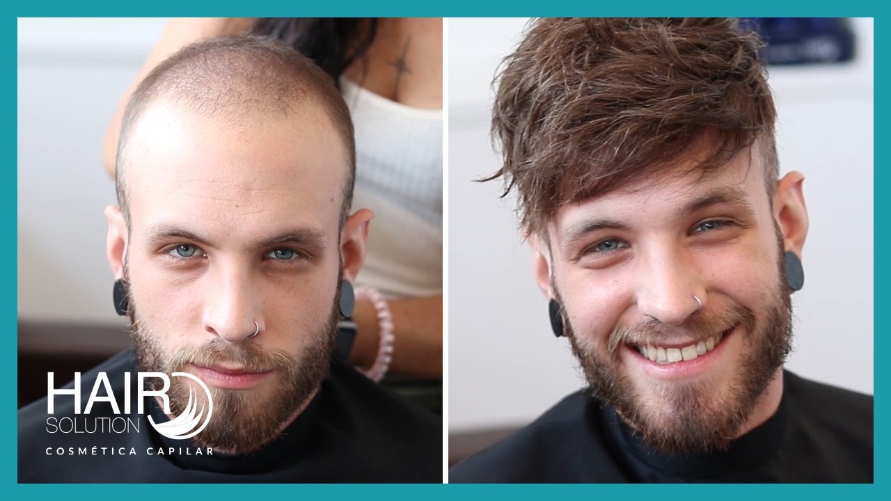 Prótesis Capilares | Recupera tu imagen | Hair Solution - YouTube