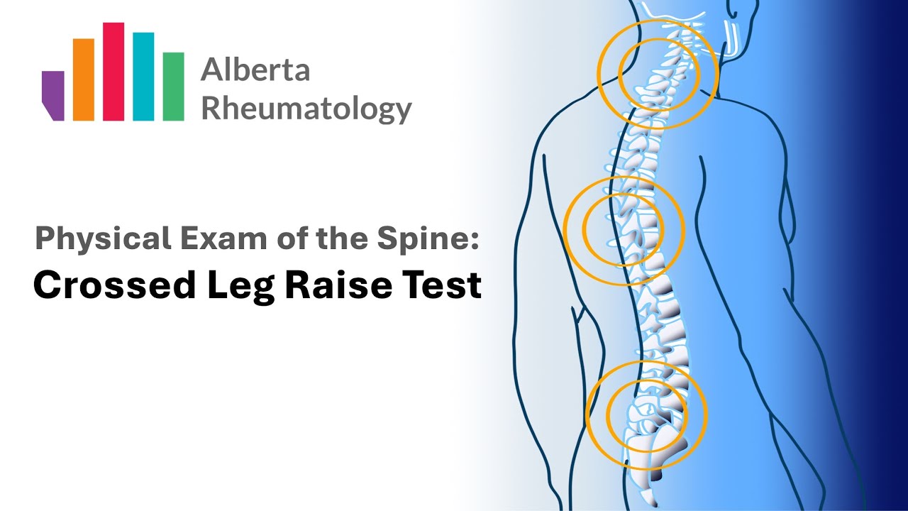 Rheumatology BACK exam: Cross Straight Leg Test - YouTube
