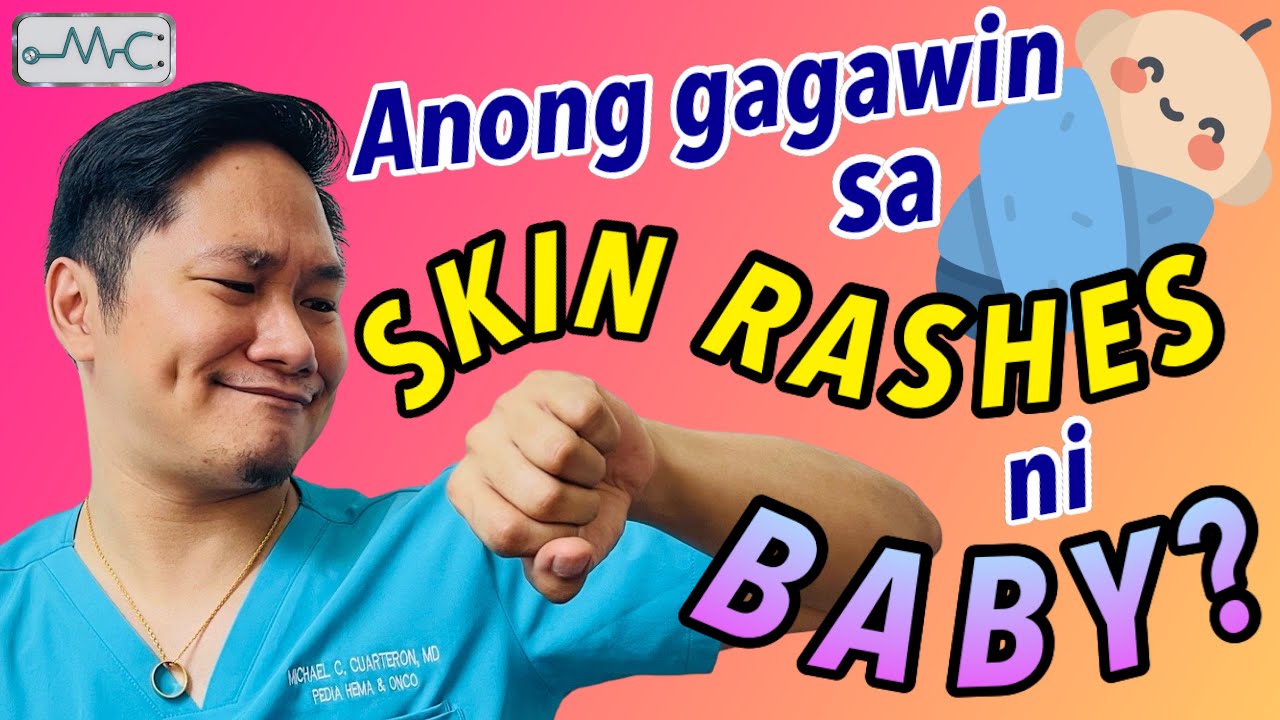 NEWBORN SKIN RASHES | SKIN RASHES NI BABY | Pedia Doc Mike - YouTube