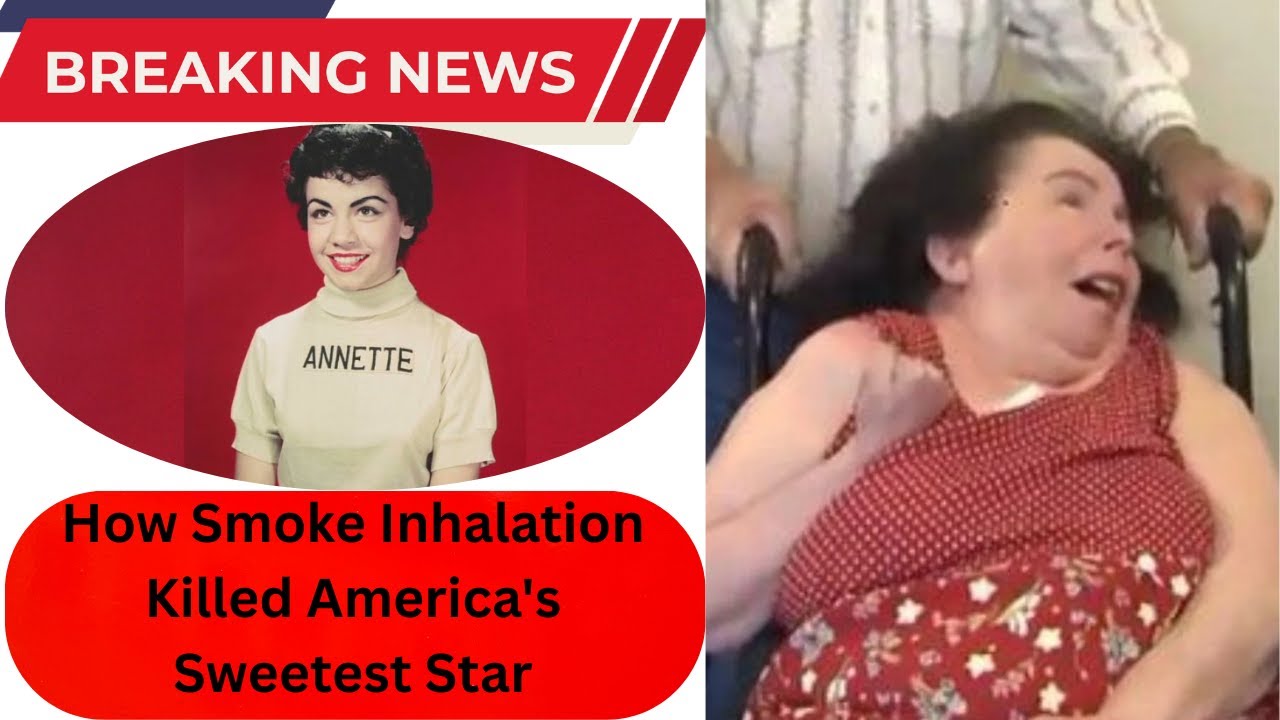 The Tragic Death of Annette Funicello - How Smoke Inhalation and ...