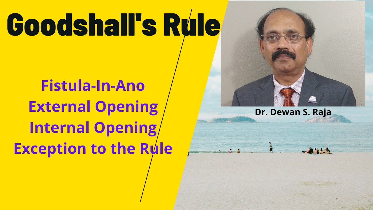 Goodsall's Rule - YouTube