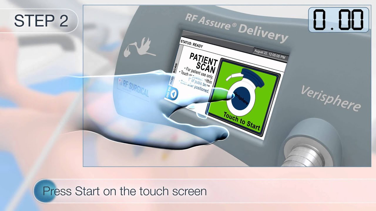 RF Assure Delivery System - YouTube