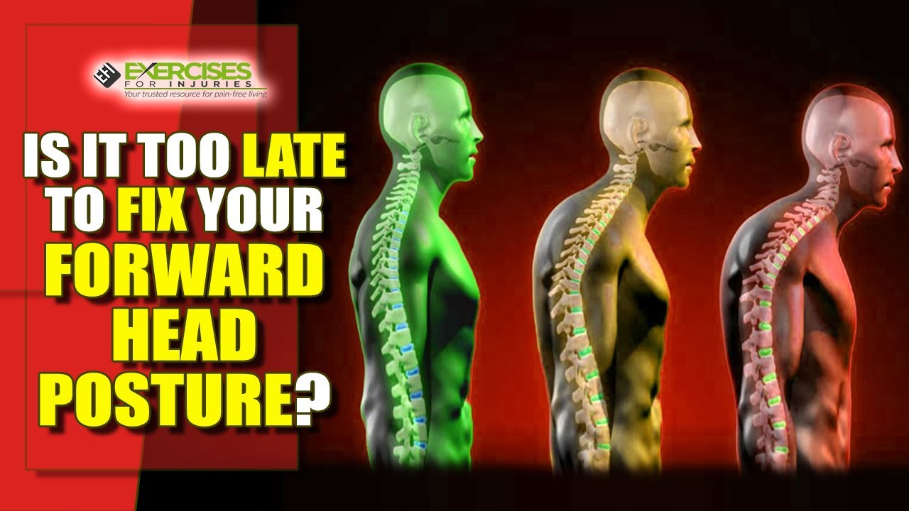 Is It Too Late To Fix Your Forward Head Posture? | Exercises For ...