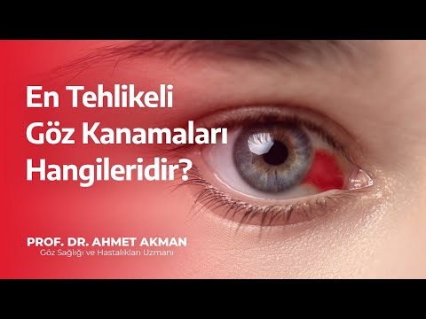 En Tehlikeli Göz İçi Kanamaları Hangileridir?