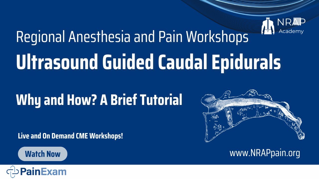 Caudal Epidurals with Ultrasound [How & Why?] A Brief Tutorial by NY ...