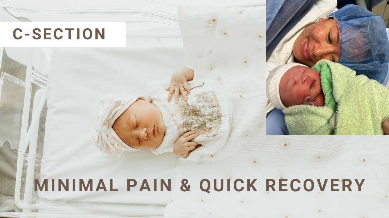 Positive C-Section Journey: Minimal Pain, Swift Recovery, Maximum ...