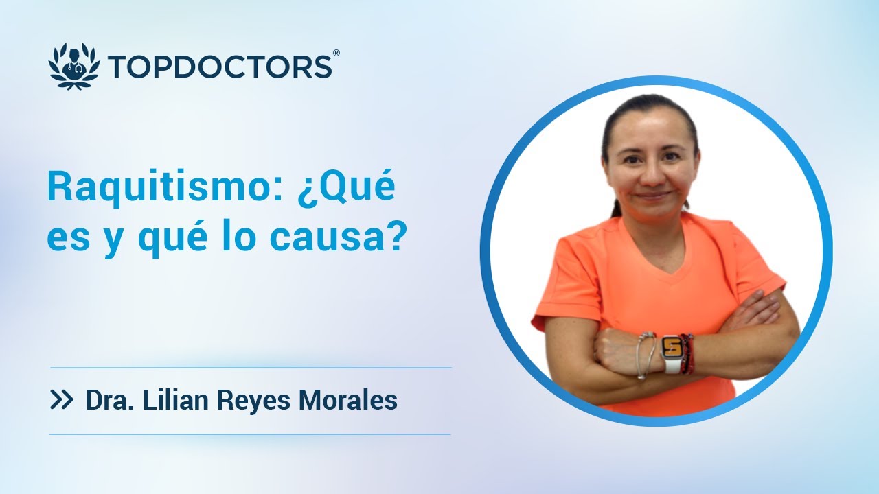 Raquitismo: ¿Qué es y qué lo causa? - YouTube