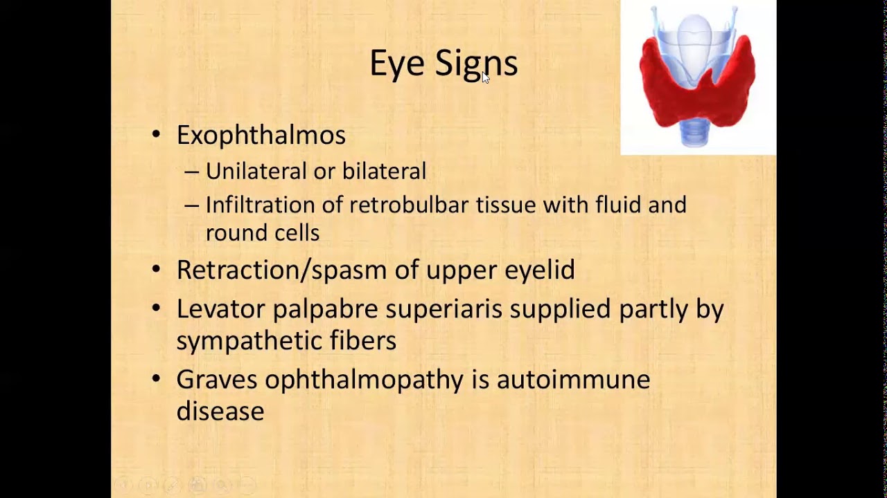 Lecture of Dr Zulfiquar Memon ( Surgery ) held on 22nd June 2020 - YouTube