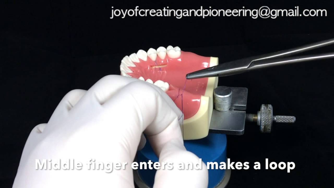 Back to the suture - Security loop suture - YouTube