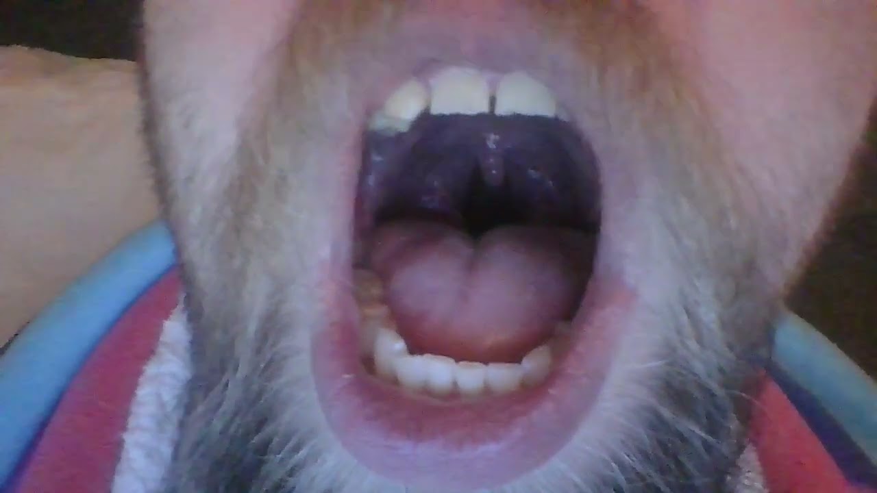 Burping With Camera Showing Inside Mouth #2 - YouTube