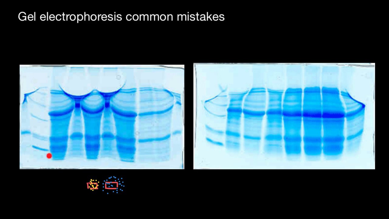 #5 Gel electrophoresis common mistakes - YouTube