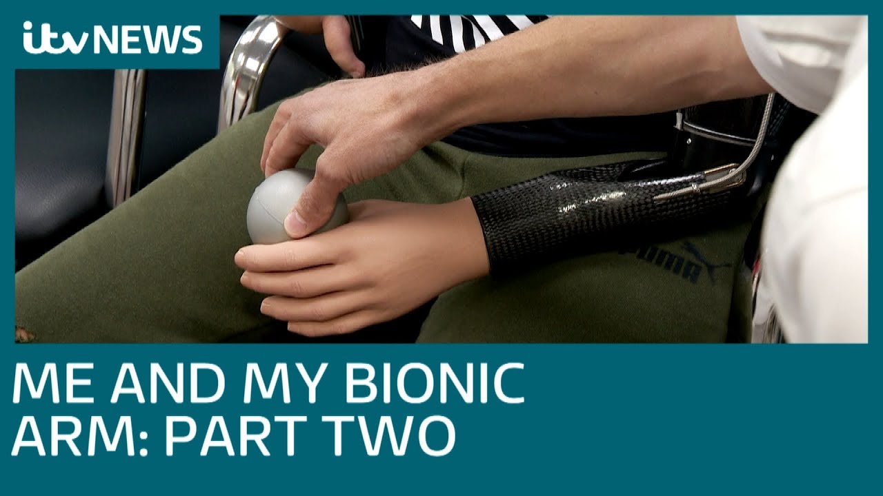 Me and my bionic arm: Part two | ITV News - YouTube