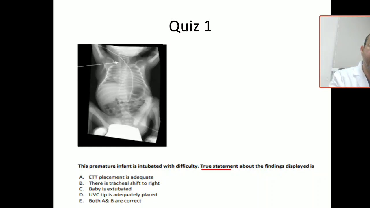 Case 4 interpretation of ETT and UVC placement, to know the course of ...