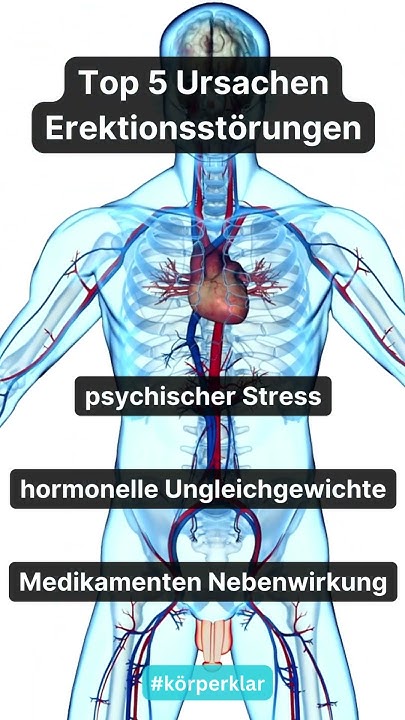 Top 5 Ursachen Erektionsstörungen #shorts - YouTube