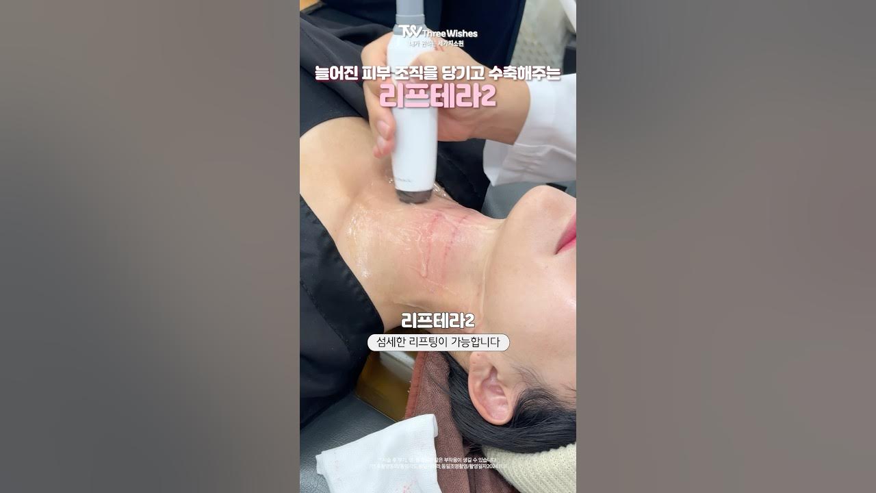 늘어진 피부 조직을 당기고 수축해주는 리프테라 리프팅레이저 초음파리프팅 리프테라 리프팅 탄력 목주름 피부탄력