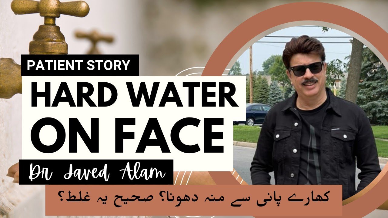 Hard Water for Facewash | Pakistan's # 1 Dermatologist explains | Dr. Javed Alam Farooqui - YouTube