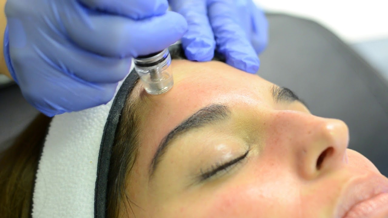 Dermalinfusion Treatment for Clearer Skin - YouTube