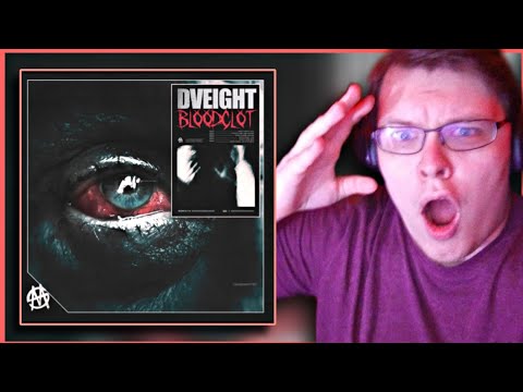 DVEIGHT 'BLOODCLOT EP' gave me BRONCHITIS - YouTube