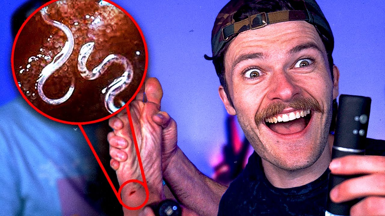 How Dirty Is My Body Under A 2000x Microscope? (very gross lol) - YouTube