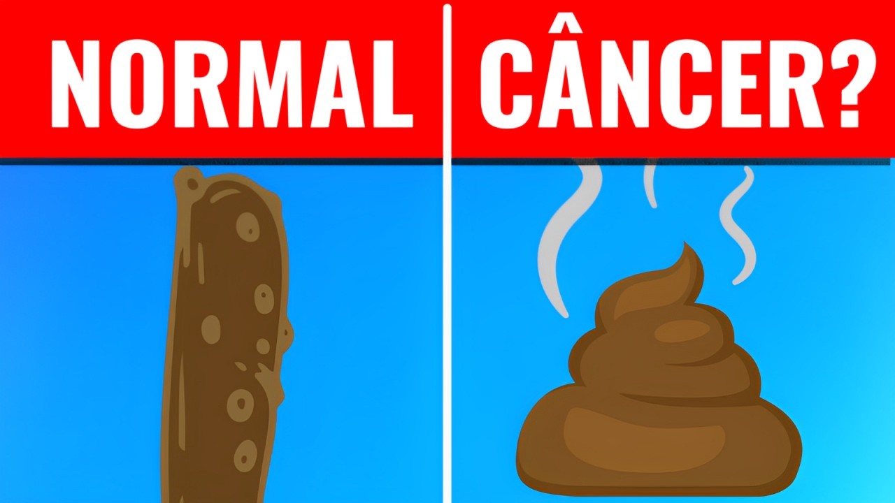 Descubra 11 Sinais Alarmantes nas Suas Fezes que Podem Revelar ...