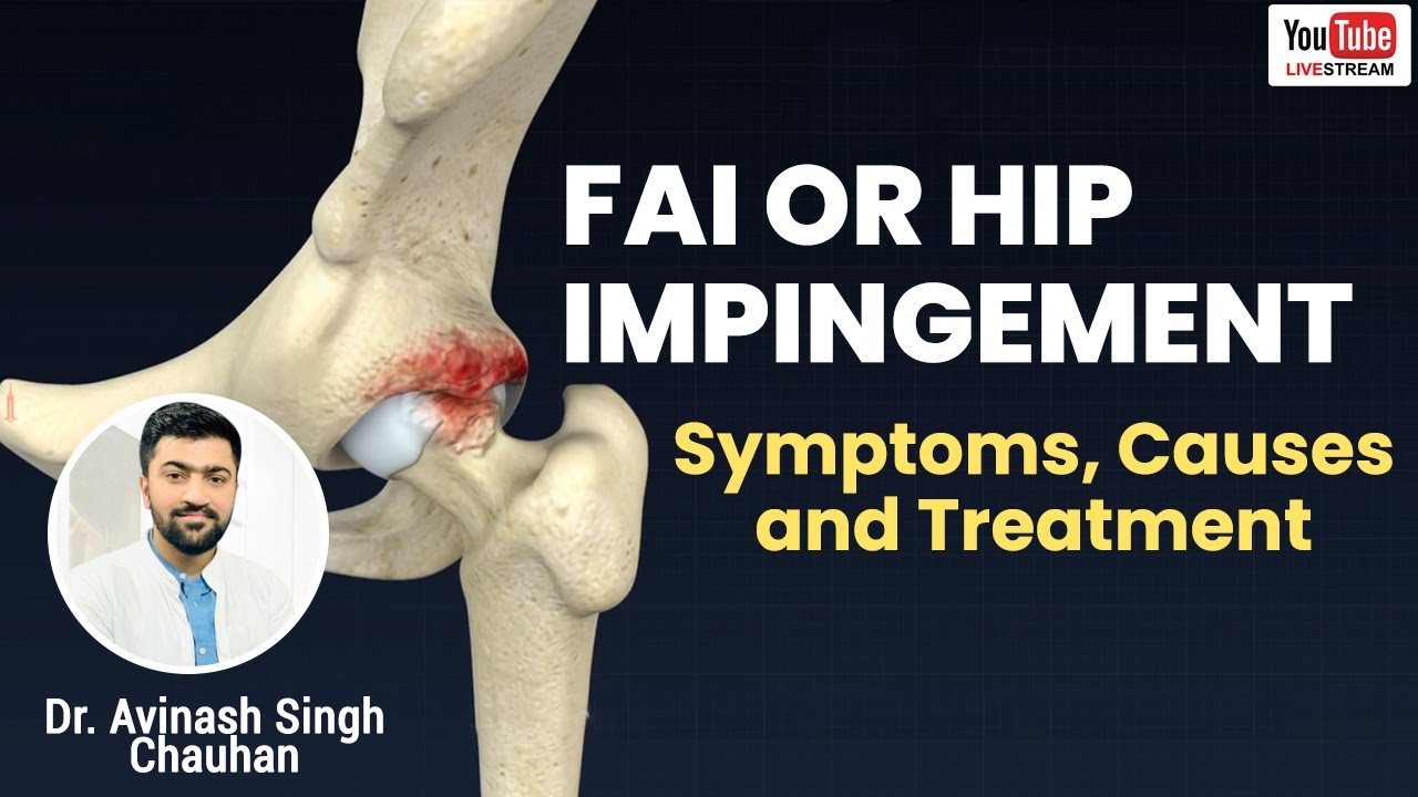 What is Hip Impingement or FAI | Symptoms, Causes & Treatment ...