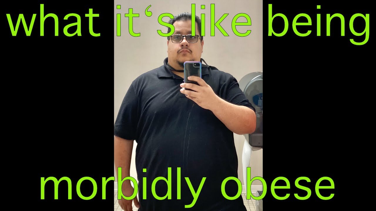 What it’s like to be morbidly obese - YouTube