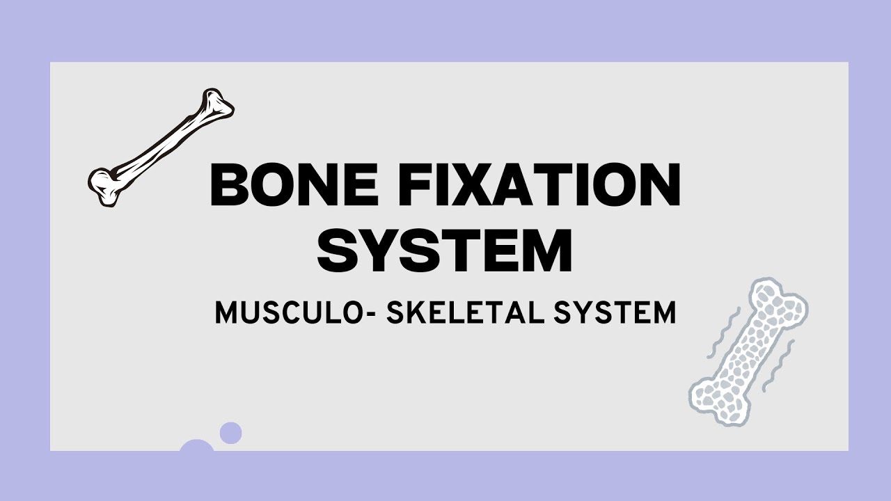 BONE FIXATION SYSTEM| CPT MUSCULO-SKELETAL SYSTEM| CPT TOPICS| MEDICAL ...