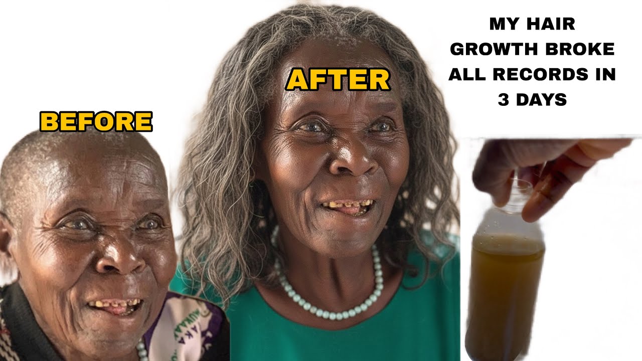 No Joke! THIS EPIC HAIR GROWTH RECIPE GROWS HAIR IN 4 WEEKS! IT GROWS ...