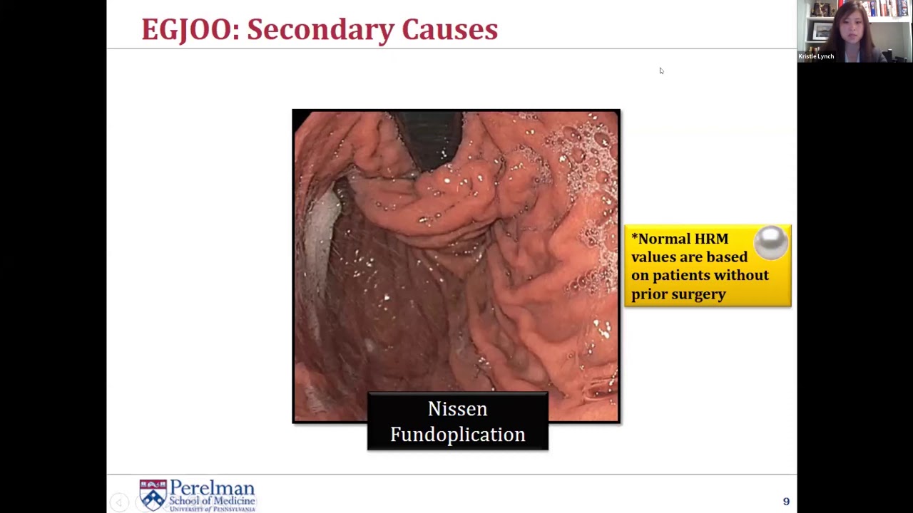 ANMS Virtual Symposia: Diagnostic and Therapeutic Approach to EGJ ...