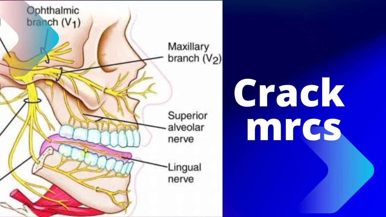 Ophthalmic branch of trigeminal nerve MRCS question solve - YouTube