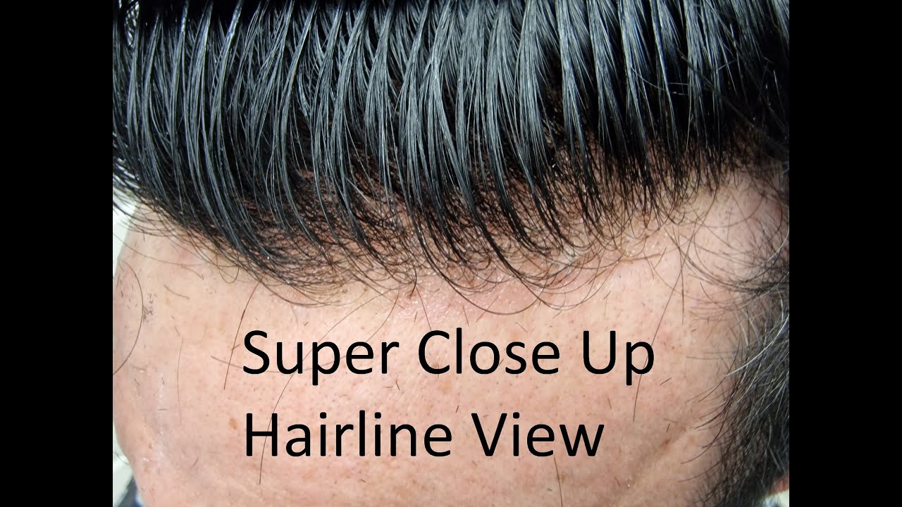 Hair System Fitting Video, Bleached Knots, Graduated Hairline, Close up ...