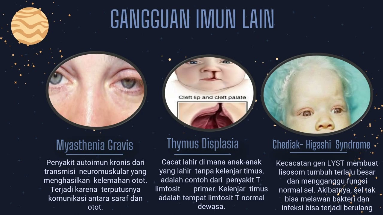 RUANG KULIAH | | IMUNOLOGI | | GANGGUAN SISTEM IMUN | Kuliah 5 menit ...