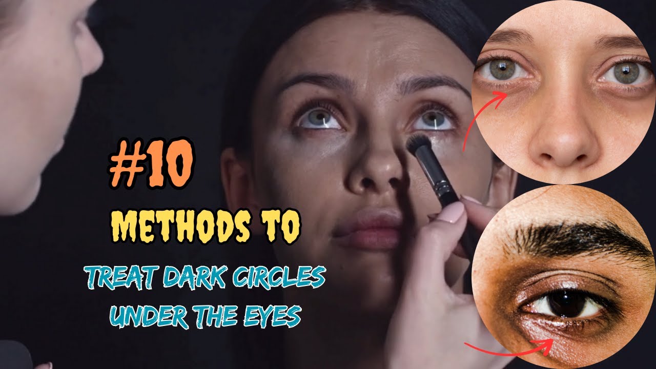 I Defeated Dark Circles Under My Eyes with These 10 Effective Methods ...