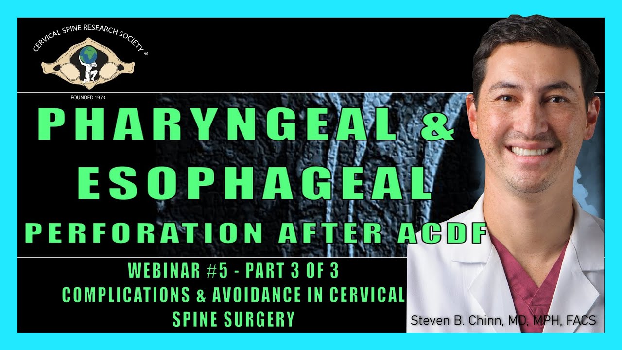 Webinar #5 Part 3 of 3 - Pharyngeal/Esophageal Perforation - Dr. Steven ...