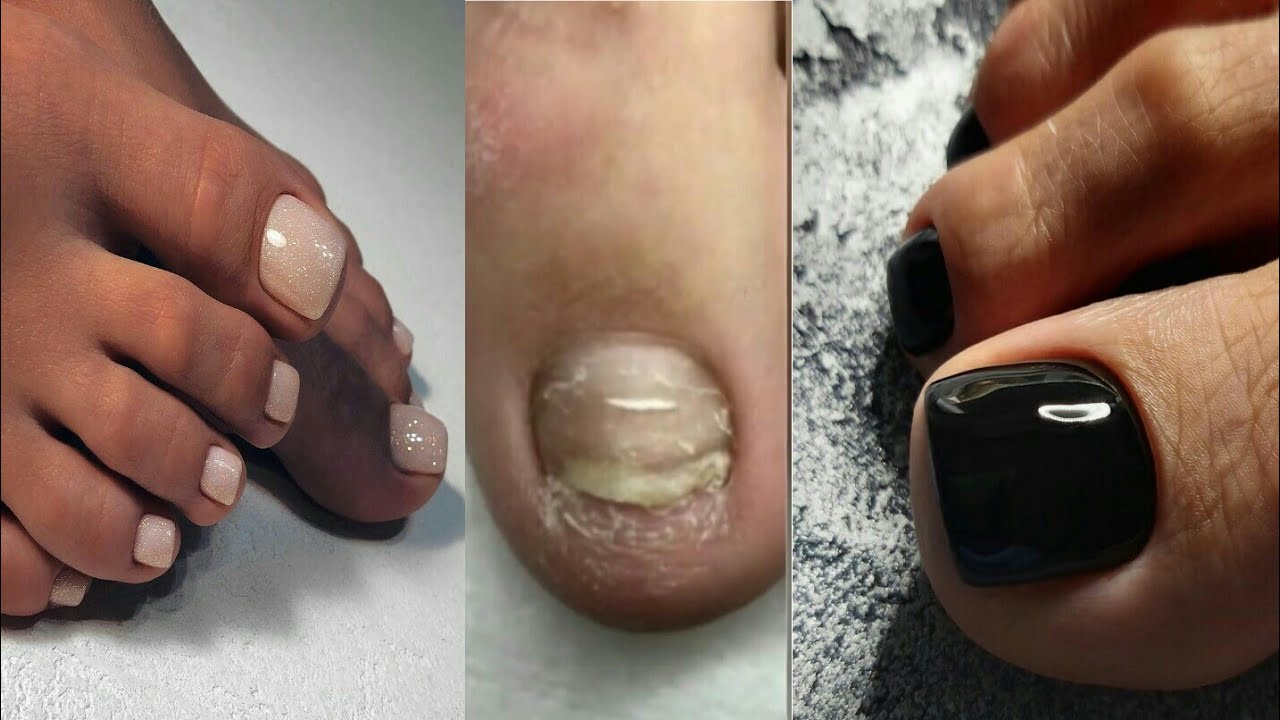 Most Satisfying Pedicure transformation 😱 best nail polish for toes ...