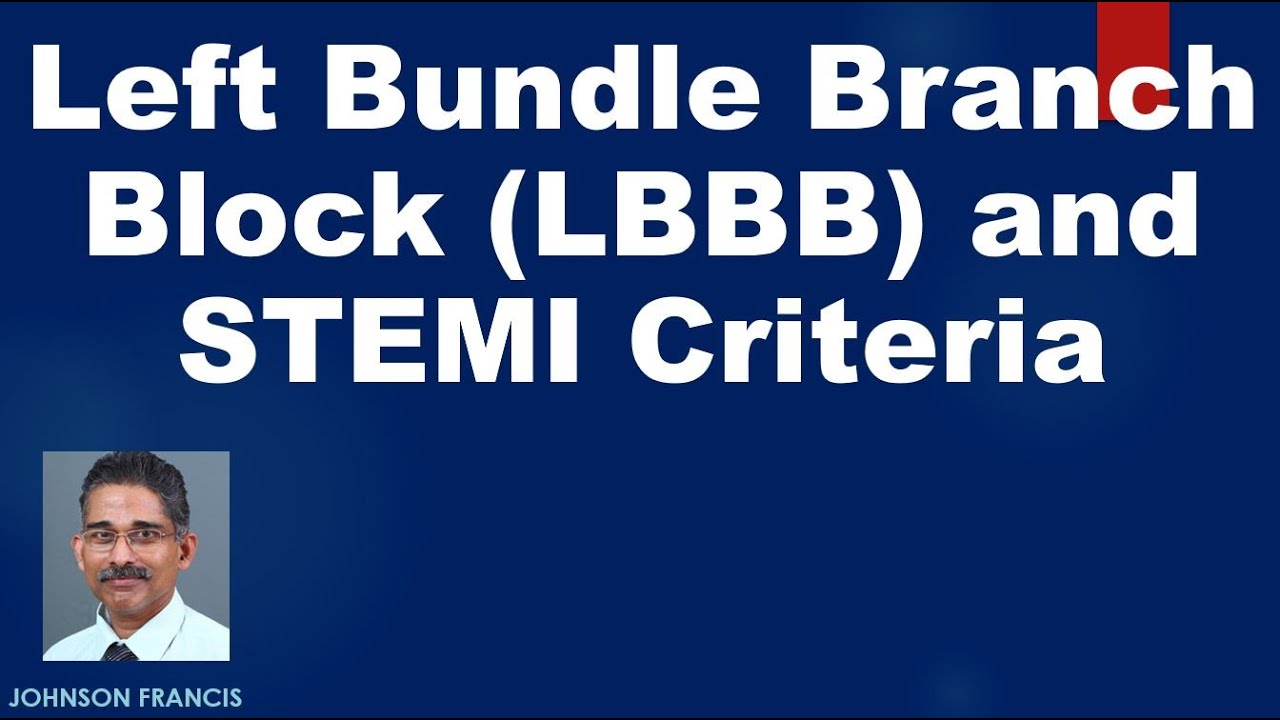 Left Bundle Branch Block LBBB and STEMI Criteria - YouTube
