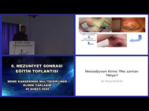Dr Polat OLGUN Neoadjuvan Kime Ne zaman Niye
