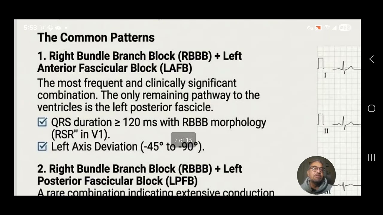 A guide to conduction blocks - YouTube