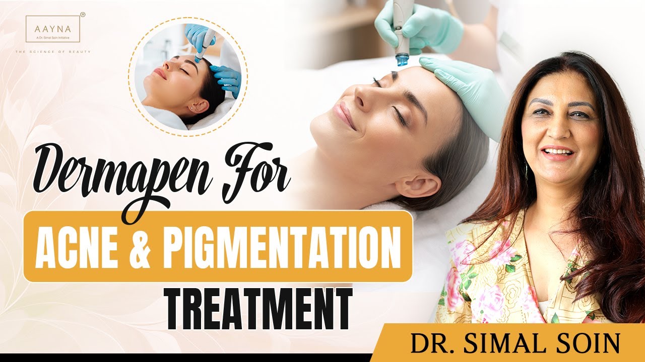 Dermapen Microneedling: For Acne Scars, Open Pores, Wrinkles ...